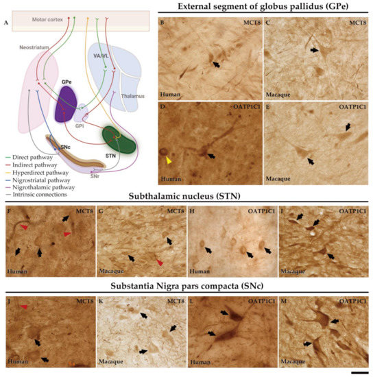 Thyroid Hormone Transporters MCT8 and OATP1C1 Are Expressed in ...