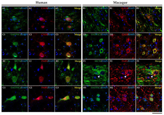 Thyroid Hormone Transporters MCT8 and OATP1C1 Are Expressed in ...