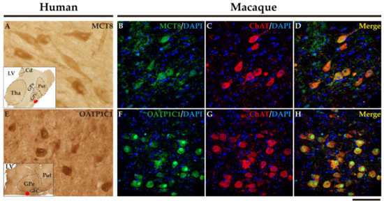 Thyroid Hormone Transporters MCT8 and OATP1C1 Are Expressed in ...