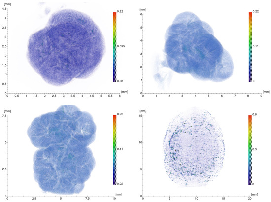IJMS | Free Full-Text | Emission and Migration of Nanoscale Particles during Osseointegration ...