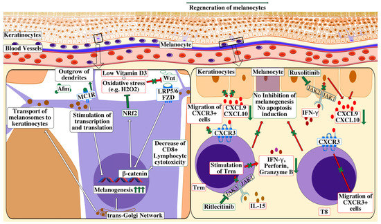 Etiopathogenesis and Emerging Methods for Treatment of Vitiligo