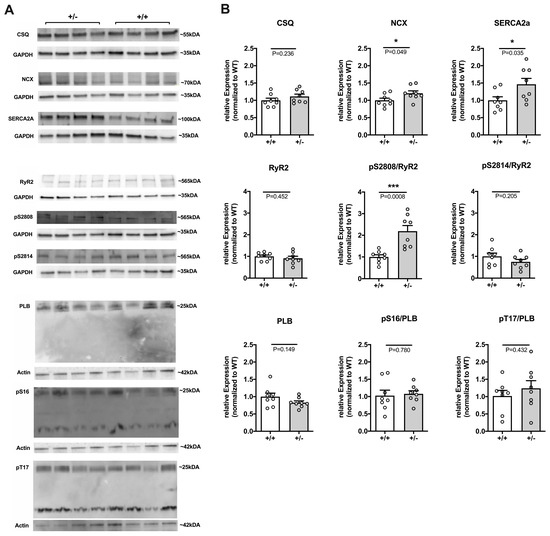Calcium Handling Remodeling Underlies Impaired Sympathetic Stress ...