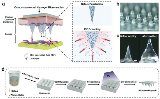Microneedle-Integrated Sensors for Extraction of Skin Interstitial ...
