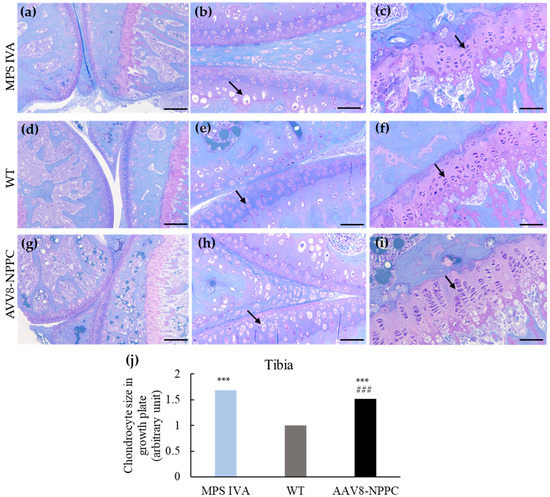 Bone Growth Induction in Mucopolysaccharidosis IVA Mouse
