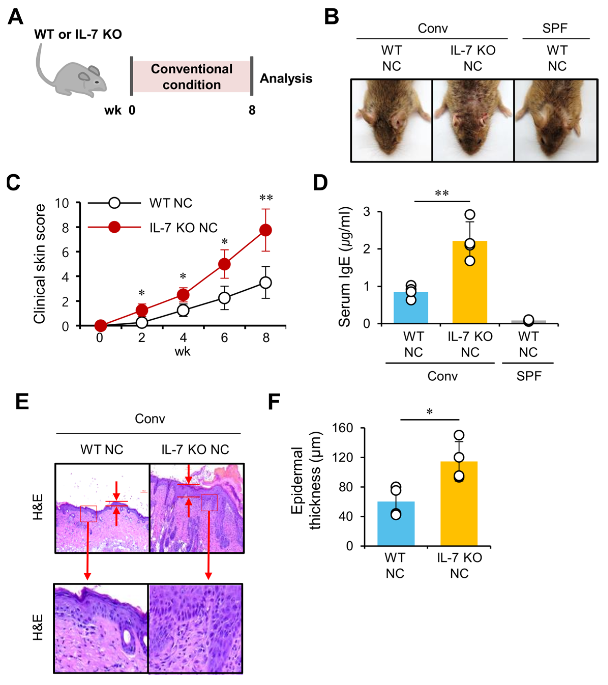 Ijms Free Full Text Il 7 Deficiency Exacerbates Atopic Dermatitis In Ncnga Mice