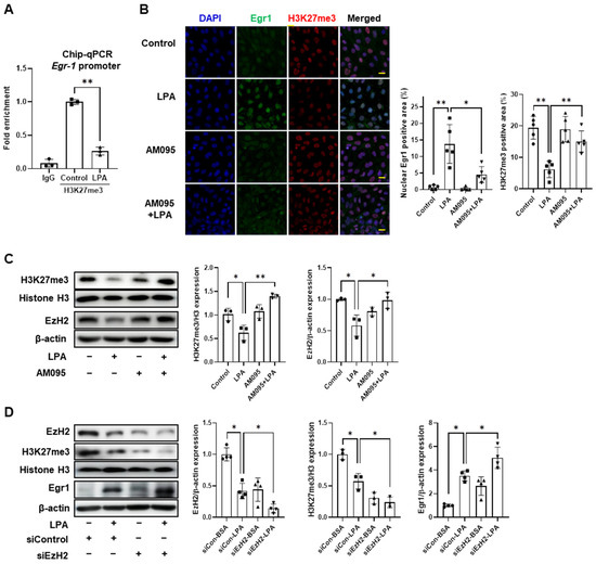 Lysophosphatidic Acid Induces Podocyte Pyroptosis in Diabetic Nephropathy by an Increase of Egr1 ...