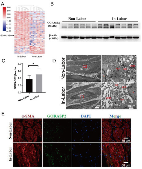 Golgi Reassembly Stacking Protein 2 Modulates Myometrial Contractility ...
