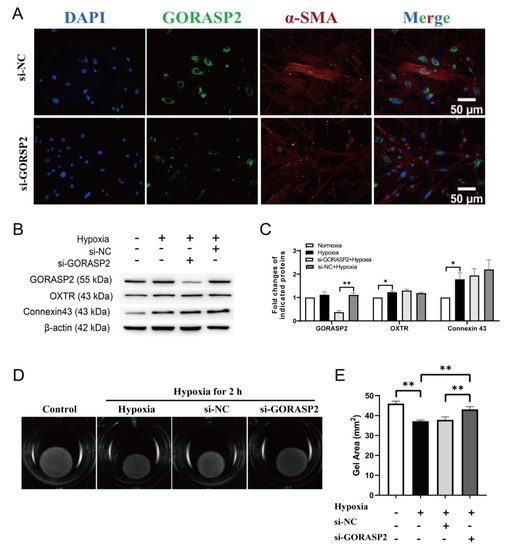 Golgi Reassembly Stacking Protein 2 Modulates Myometrial Contractility ...