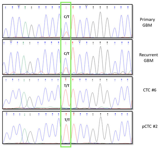 Innovative Approach to Isolate and Characterize Glioblastoma ...