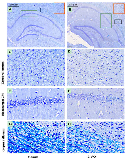 Abnormal Spontaneous Discharges of Primary Sensory Neurons and Pain ...