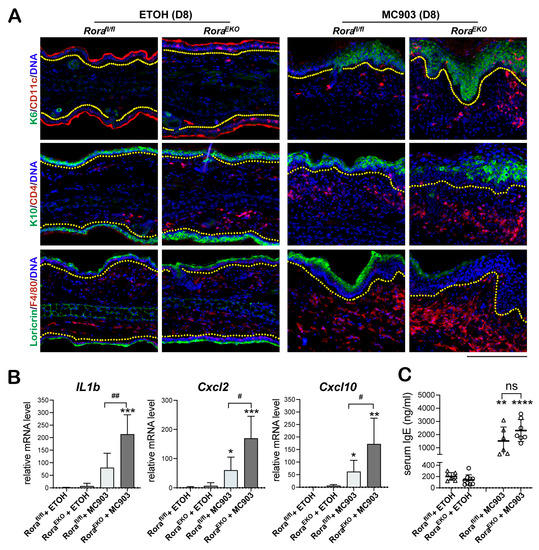 Epidermal Loss of RORα Enhances Skin Inflammation in a MC903-Induced ...