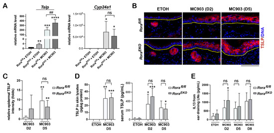 Epidermal Loss of RORα Enhances Skin Inflammation in a MC903-Induced ...