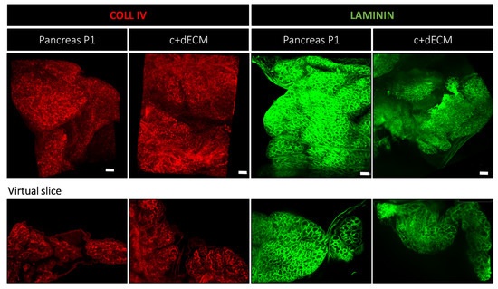 In-Depth Analysis of the Pancreatic Extracellular Matrix during ...