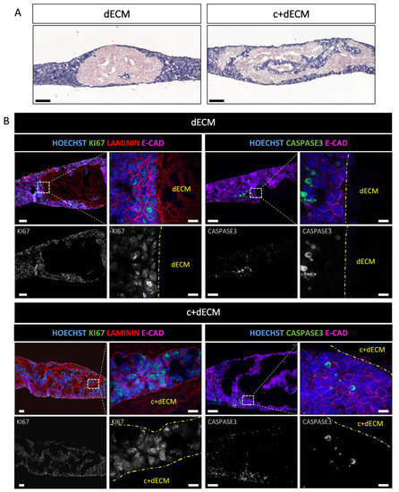 In-Depth Analysis of the Pancreatic Extracellular Matrix during ...