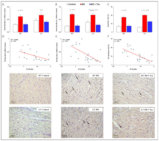 Beneficial Effects of Tacrolimus on Brain-Death-Associated Right ...