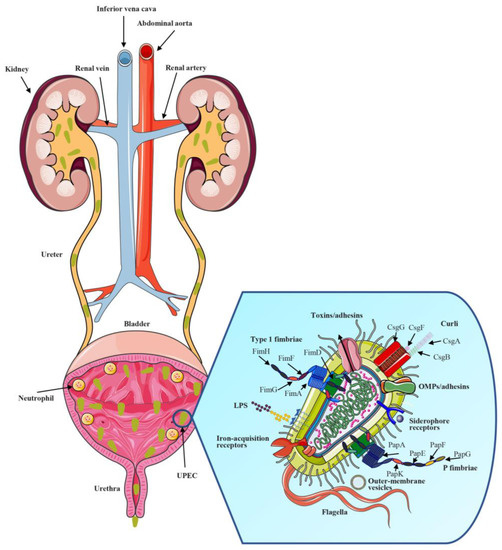 Urinary Tract Infections Caused by Uropathogenic Escherichia coli ...