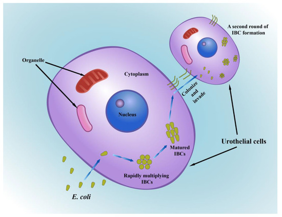 Urinary Tract Infections Caused by Uropathogenic Escherichia coli ...