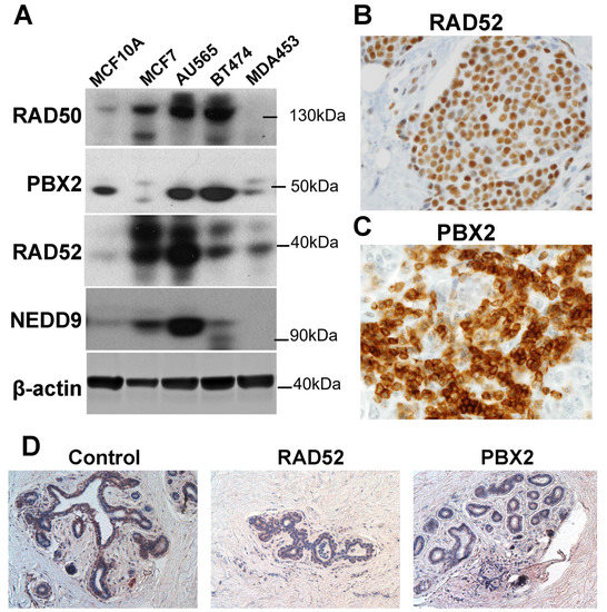 Expression-Based Diagnosis, Treatment Selection, and Drug Development ...