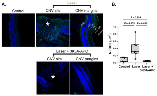 3K3A-Activated Protein C Inhibits Choroidal Neovascularization Growth ...