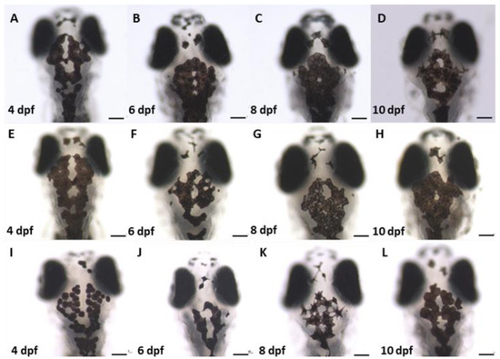 Characterising the Effect of Wnt/β-Catenin Signalling on Melanocyte ...