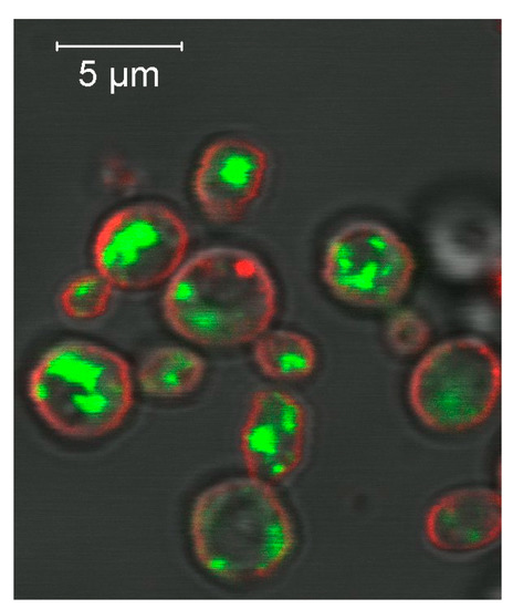 Yeast Heterologous Expression Systems for the Study of Plant Membrane ...