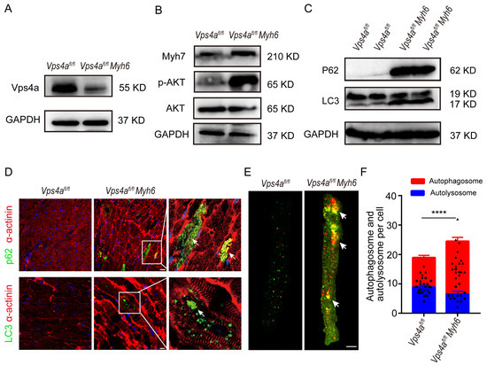 Vps4a Regulates Autophagic Flux to Prevent Hypertrophic Cardiomyopathy
