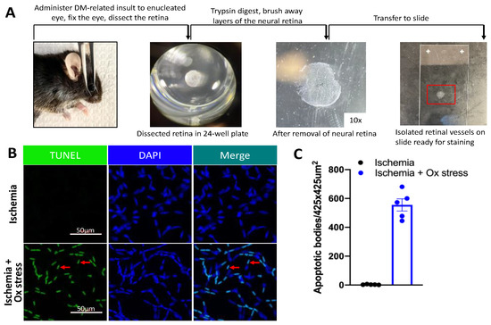 IJMS | Free Full-Text | The Slow Progression of Diabetic Retinopathy Is ...