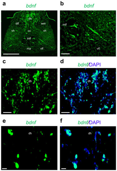Transcription Pattern of Neurotrophic Factors and Their Receptors in ...