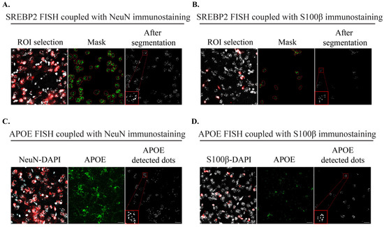 Cell-Type Specific Regulation of Cholesterogenesis by CYP46A1 Re ...