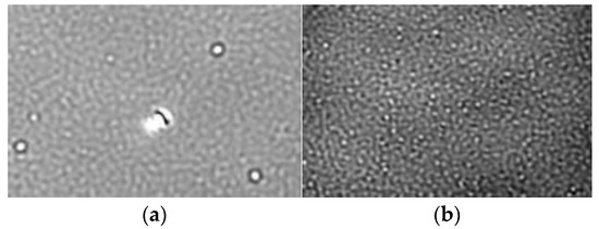 Quantification of Empty, Partially Filled and Full Adeno-Associated ...