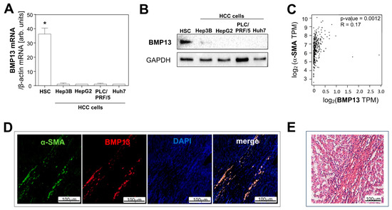 Bone Morphogenetic Protein 13 Has Protumorigenic Effects on ...