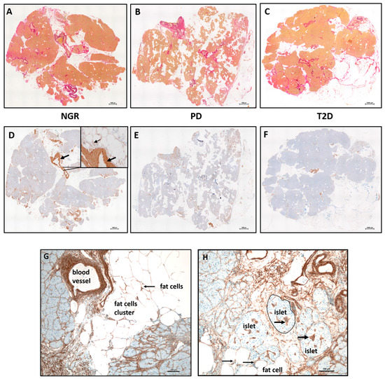 IJMS | Free Full-Text | Extracellular Matrix Expression in Human ...
