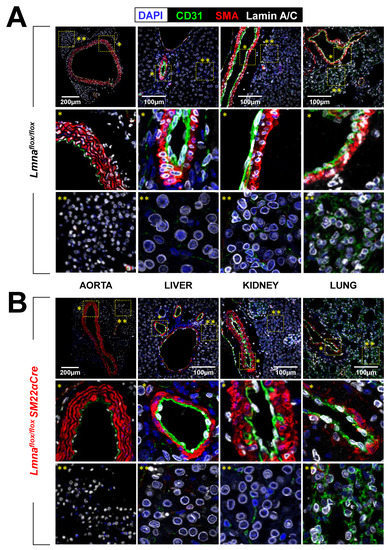 Lamin A/C Ablation Restricted to Vascular Smooth Muscle Cells ...