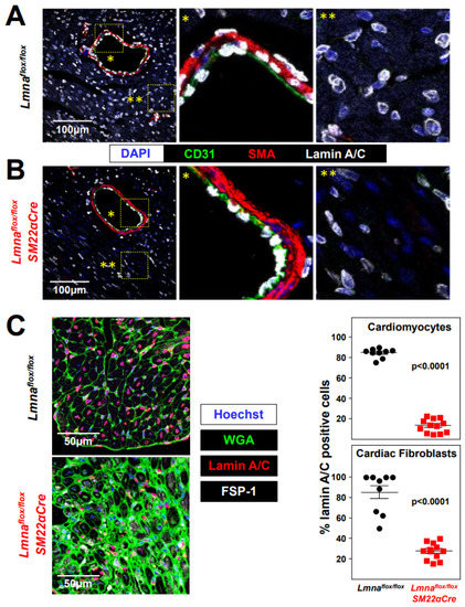 Lamin A/C Ablation Restricted to Vascular Smooth Muscle Cells ...
