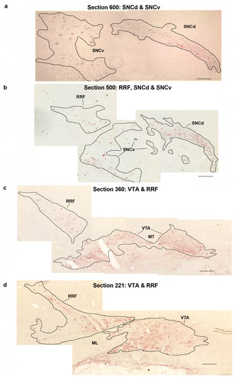 IJMS | Free Full-Text | A Novel Rat Model of ADHD-like Hyperactivity ...