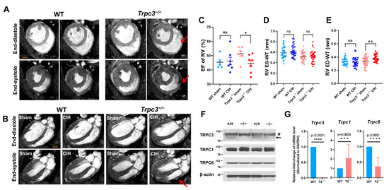 Role of TRPC3 in Right Ventricular Dilatation under Chronic ...