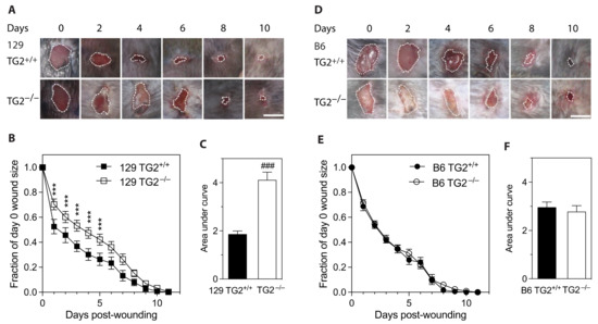 Transglutaminase 2 Facilitates Murine Wound Healing in a Strain ...