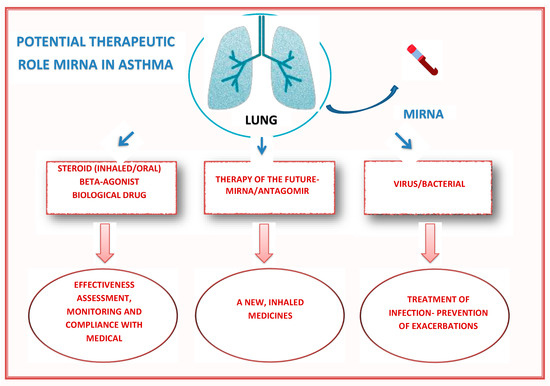 miRNAs as Modern Biomarkers in Asthma Therapy