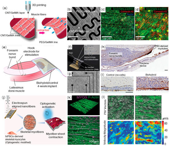 Induced Pluripotent Stem Cells for Tissue-Engineered Skeletal Muscles