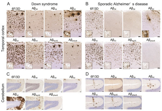 IJMS | Free Full-Text | Distinct Molecular Signatures of Amyloid-Beta ...