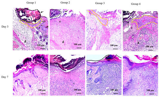 Effective Healing of Staphylococcus aureus-Infected Wounds in Pig ...