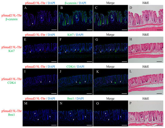 A Short-Term Model of Colitis-Associated Colorectal Cancer That ...