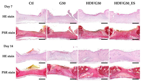 The Synergistic Effect of Electrical Stimulation and Dermal Fibroblast ...