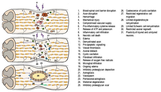 Mesenchymal Stem Cell Therapy in Traumatic Spinal Cord Injury: A ...