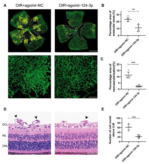 MicroRNA-124-3p Attenuated Retinal Neovascularization in Oxygen-Induced ...