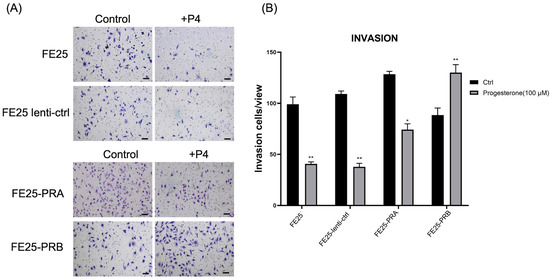 Effects of the Overexpression of Progesterone Receptors on a Precancer ...