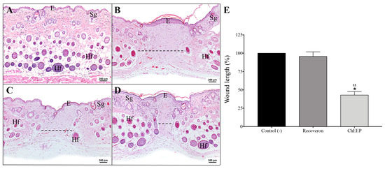 Anti-Inflammatory and Histological Analysis of Skin Wound Healing ...