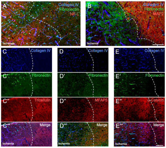 IJMS | Free Full-Text | Tricellulin, α-Catenin and Microfibrillar ...