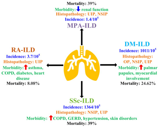The Role of Macrophages in Connective Tissue Disease-Associated ...