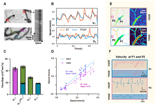 Optical Flow-Based Full-Field Quantitative Blood-Flow Velocimetry Using ...